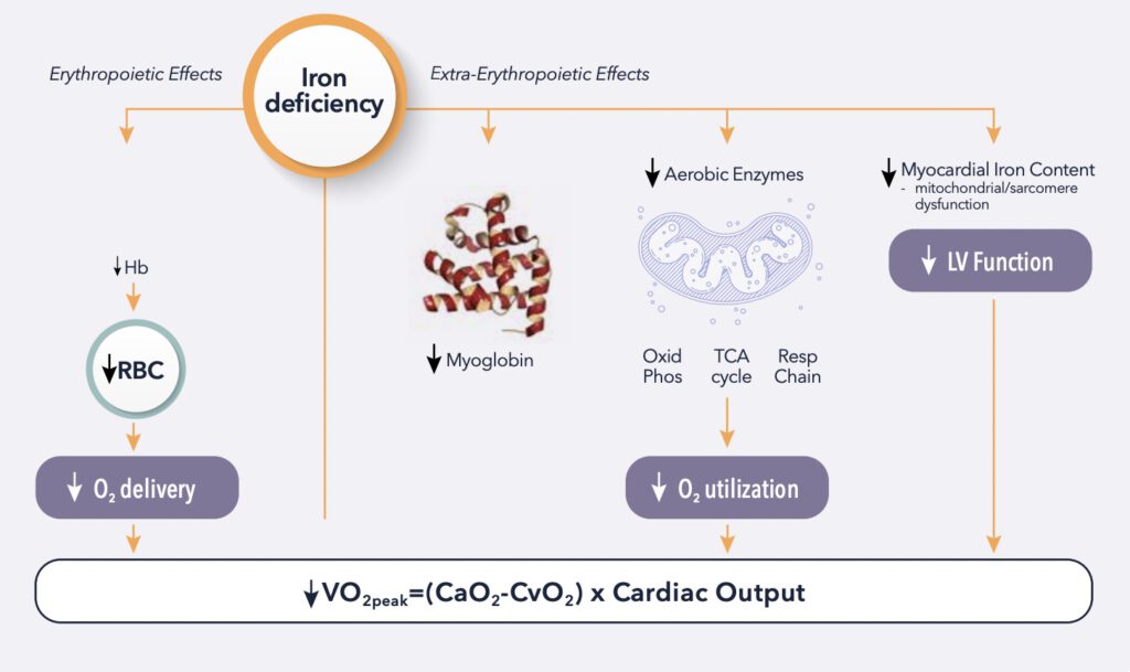 Impact of Iron Deficiency in Heart Failure | Know ID in HF