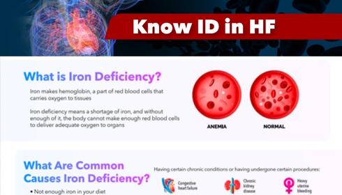 Know Iron Deficiency (ID) in Heart Failure - Know ID in HF